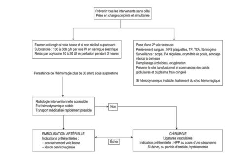 Hémorragie du post-partum immédiat - MedG