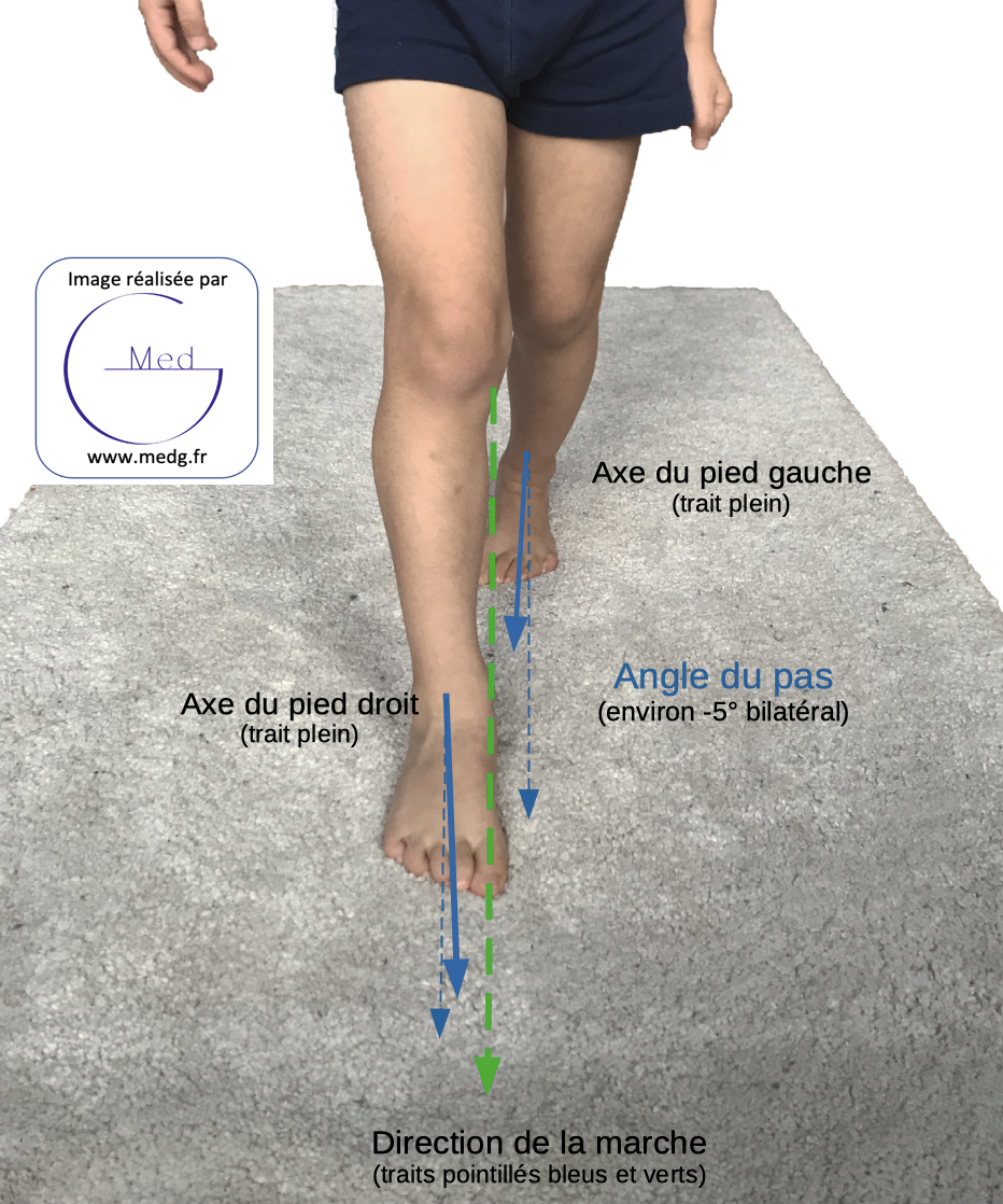 Examen orthopédique de l‘enfant - MedG