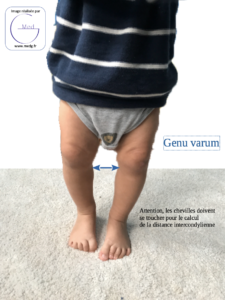 Examen orthopédique de l‘enfant - MedG